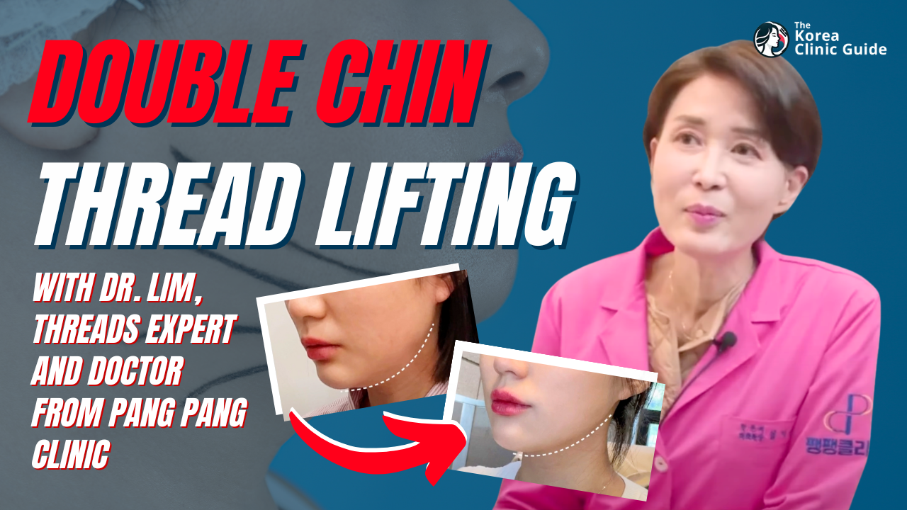 Double Chin Thread Facelifting in Korea Q&A with Pangpang Thread Lift ...