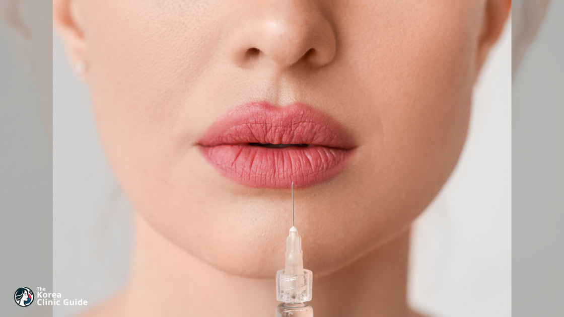 Lip Fillers in Korea Best Clinics Costs Procedure Types More