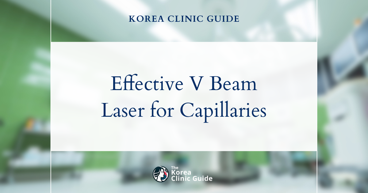 Effective V Beam Laser Treatment for Broken Capillaries in Korea: Clear ...