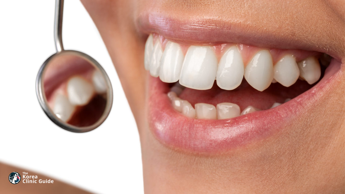 Protruding Teeth Correction in Korea | Best Clinics, Costs, Procedure ...