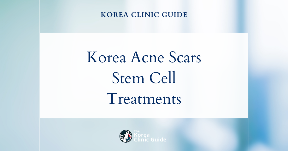 Korea Acne Scars Treatment: Advanced Stem Cell Acne Scar Procedures for ...