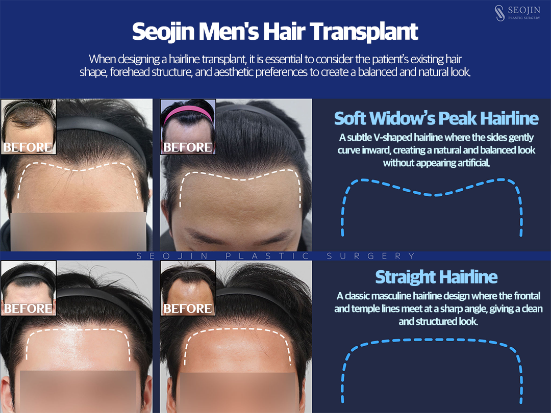 Widows Peak Vs Straight Hairline Widow's Peak: The Best Styles For