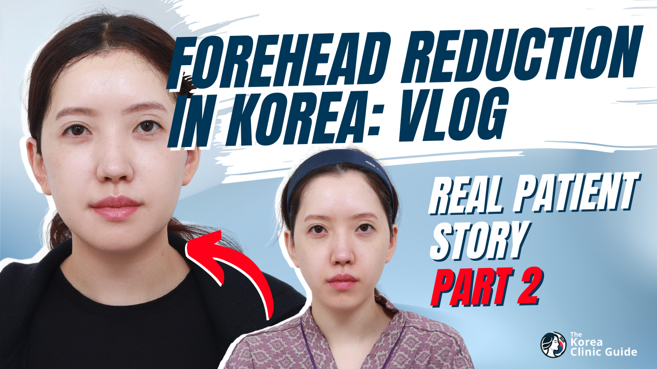 Forehead Reduction pt 2 in Korea Before & After│Real Patient Results ...