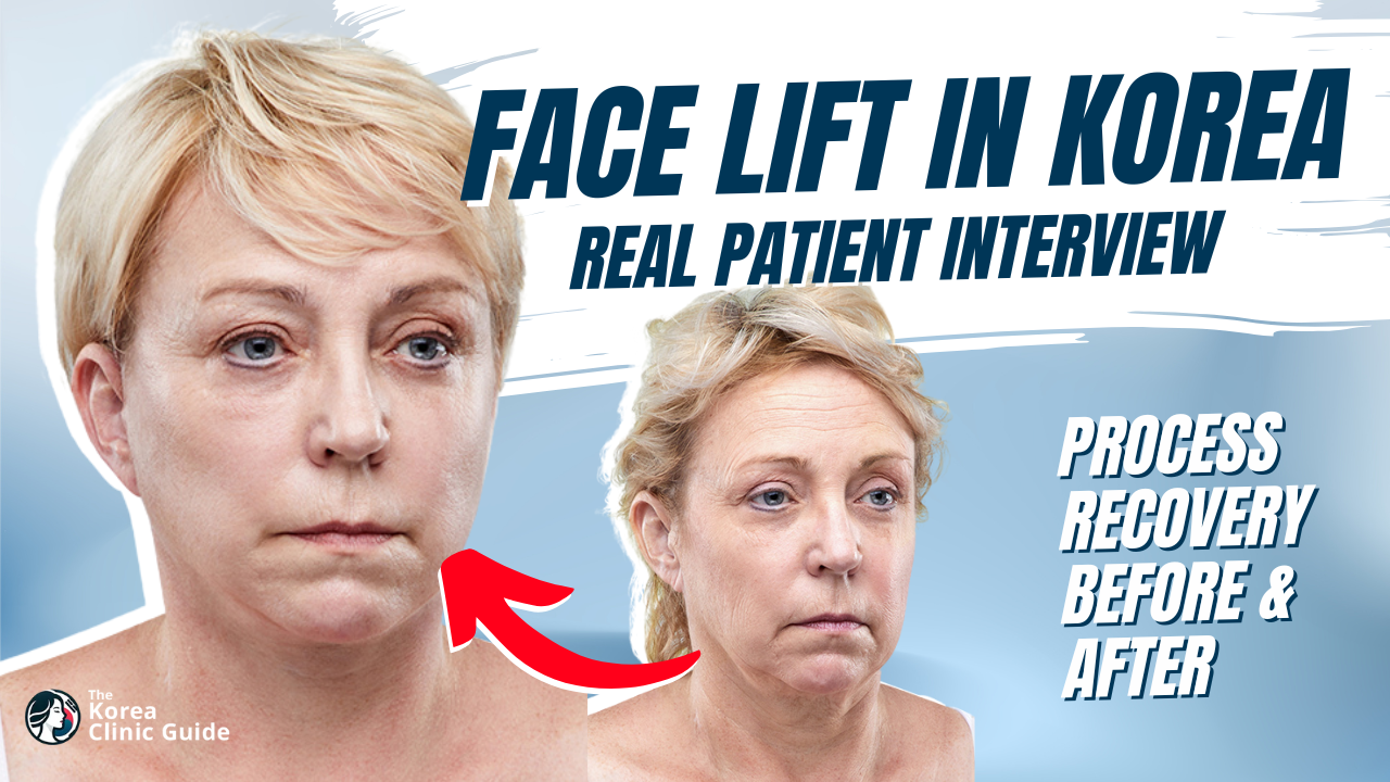 Getting A Face & Neck Lift In Korea│Real Patient Interview with Shin ...